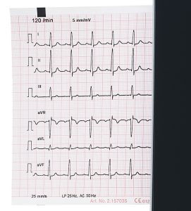 ECG Recording Paper Rolls and Packs – ECG Paper for CardioPad-2 ECG ...